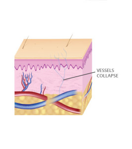 Cosmetic Dermatology Treatments - Clarus Dermatology Medical Surgical ...