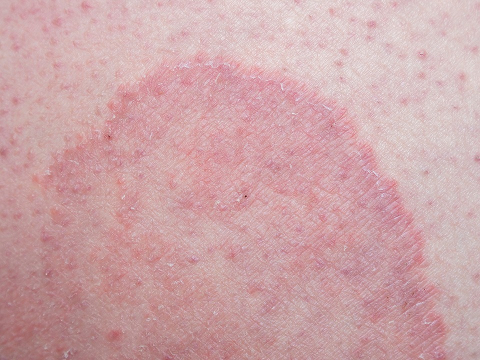 Medical Dermatology Specialists | Clarus Dermatology