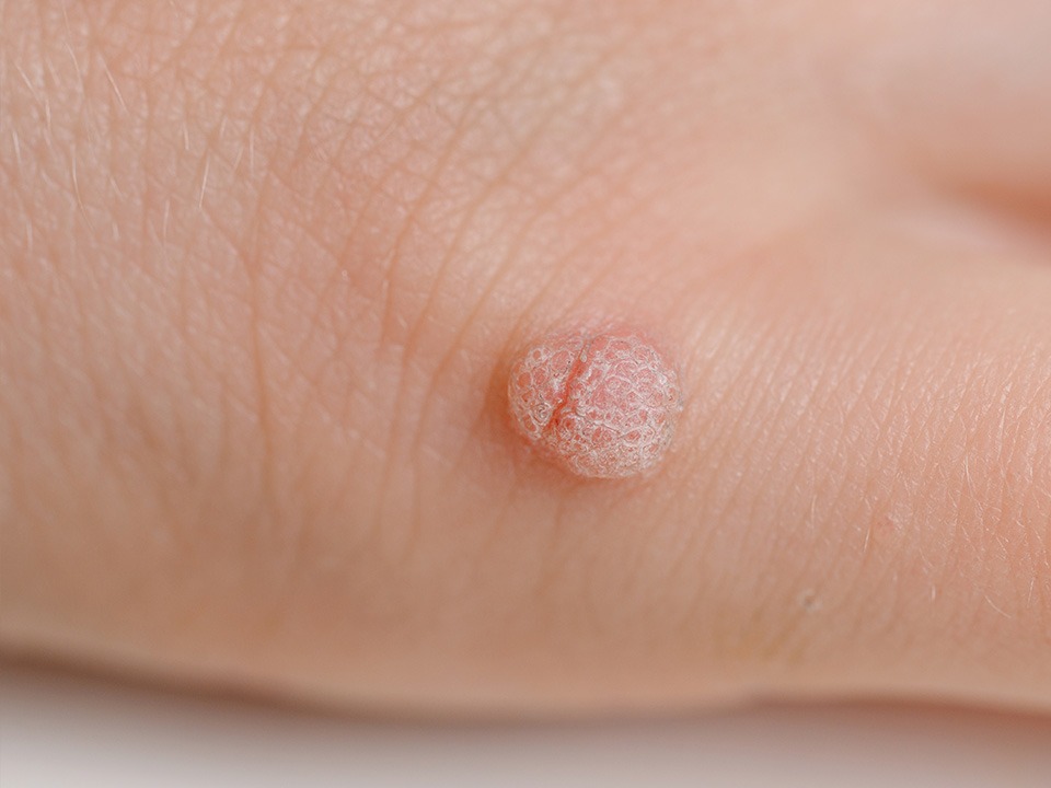 Medical Dermatology Specialists | Clarus Dermatology