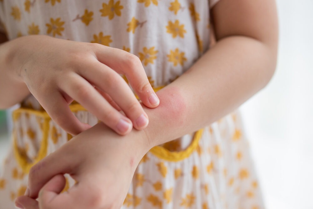 Pediatric Dermatology Myths | Debunking Kids’ Skin Condition Misconceptions